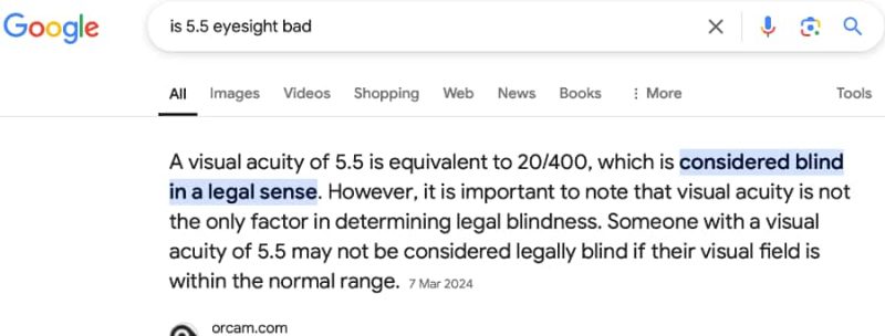 Is -5.5 Eyesight Bad? Yes — Here’s What To Do - Endmyopia®